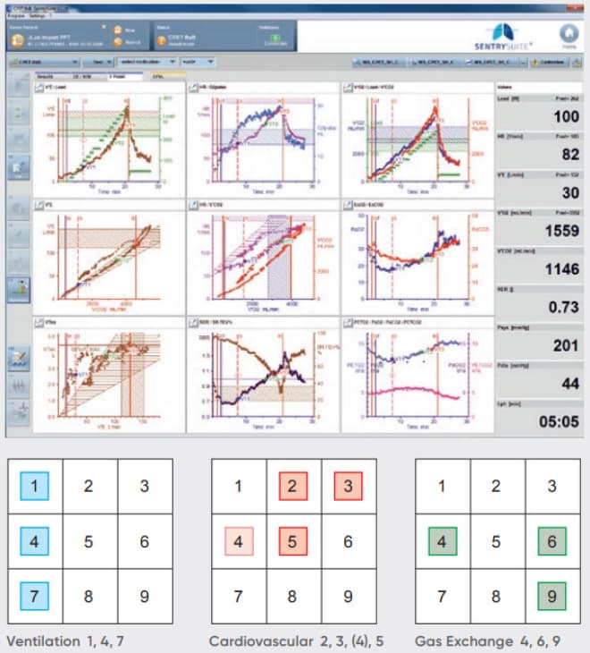 Vyntus CPX: Elevate Performance Analysis - GenWorks