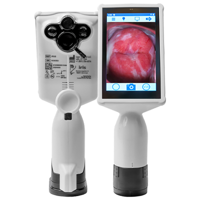 Eva Pro - Cervical Screening Device | GenWorks